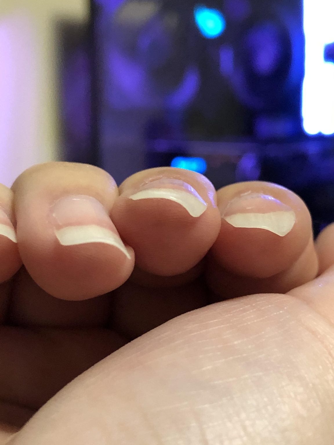 How to Stop Fingernails from Curling: Effective Solutions and Tips